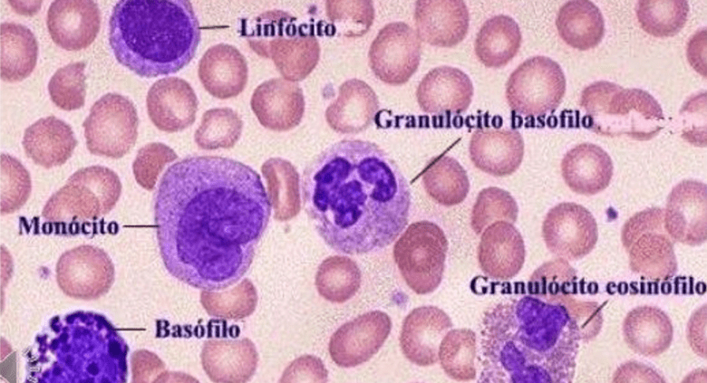 Cosa significa avere linfociti alti e bassi?