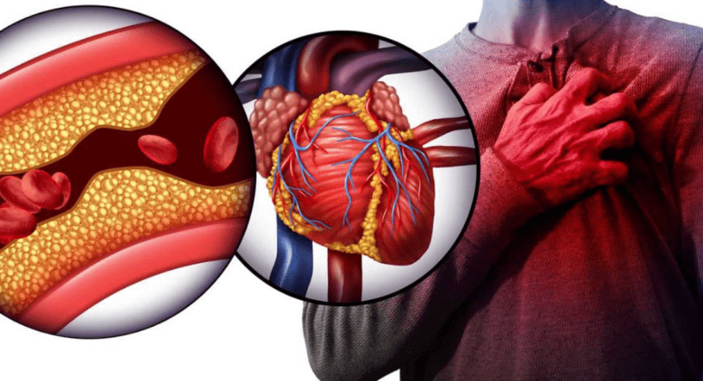 ¿Qué significa Colesterol LDL alto? Cuidados y control
